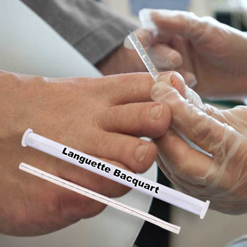 Languette de correction d'orthonyxie en titane Bacquart